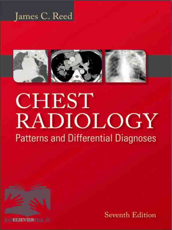 کتاب رادیولوژی قفسه سینه(ویراست7)(Chest Radiology: Patterns and ...